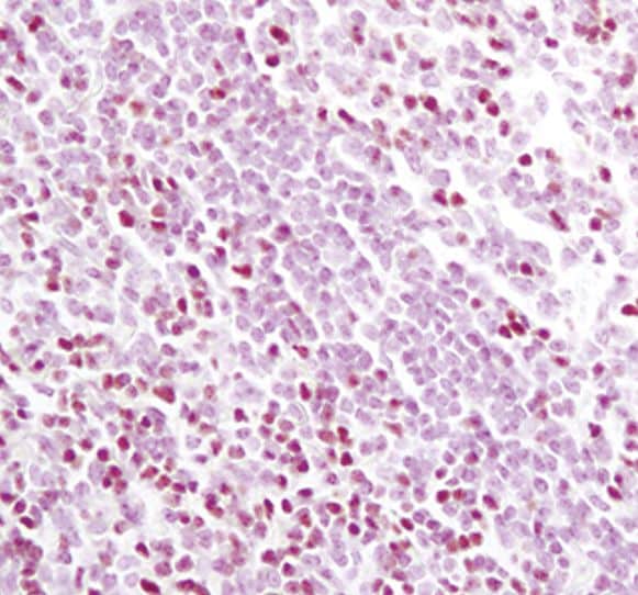 TCF7 Antibody (MA5-14965)