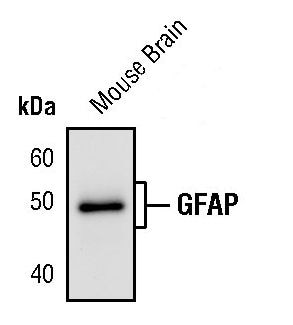 GFAP Antibody (MA5-15086)