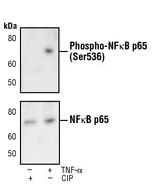 Phospho-NFkB p65 (Ser536) Antibody (MA5-15160)