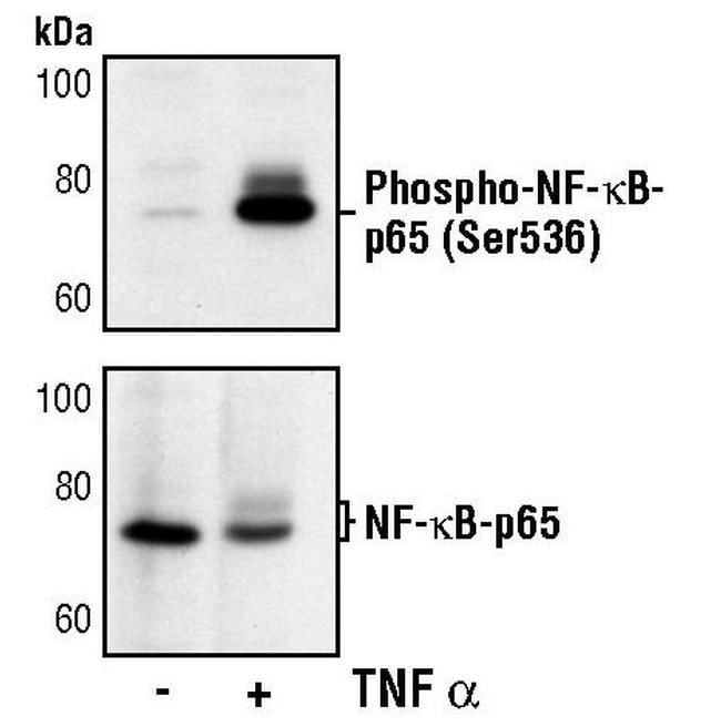 Phospho-NFkB p65 (Ser536) Antibody (MA5-15181)