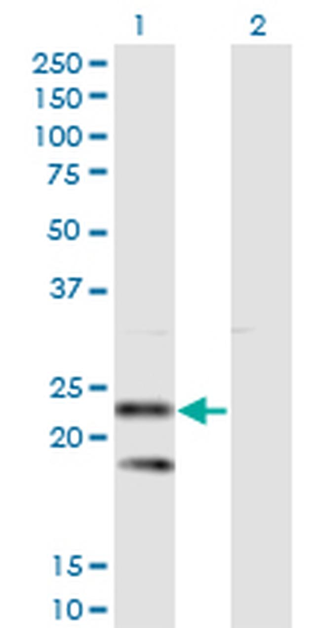 SSR2 Antibody (MA5-20028)