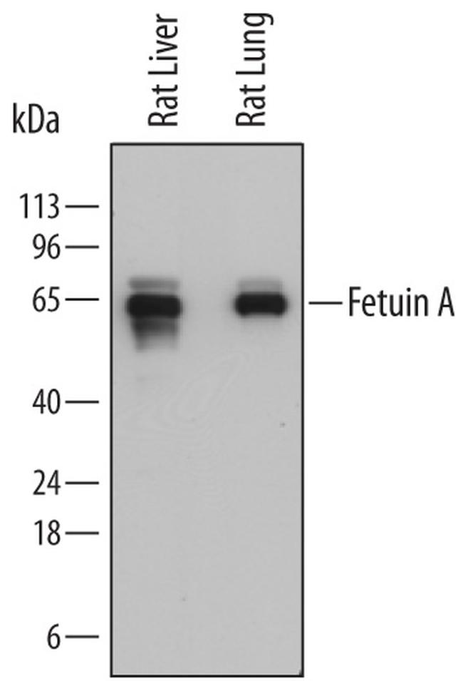 Fetuin A Antibody (MA5-24375)
