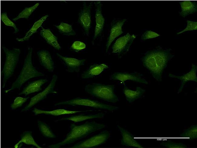 CSAD Antibody (MA5-24559)