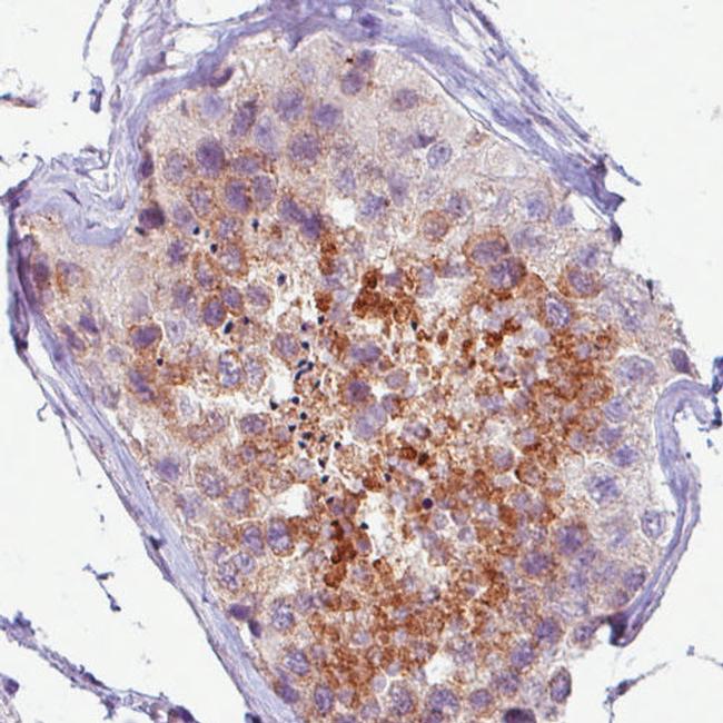 PCM1 Antibody (Monoclonal, CL0206)