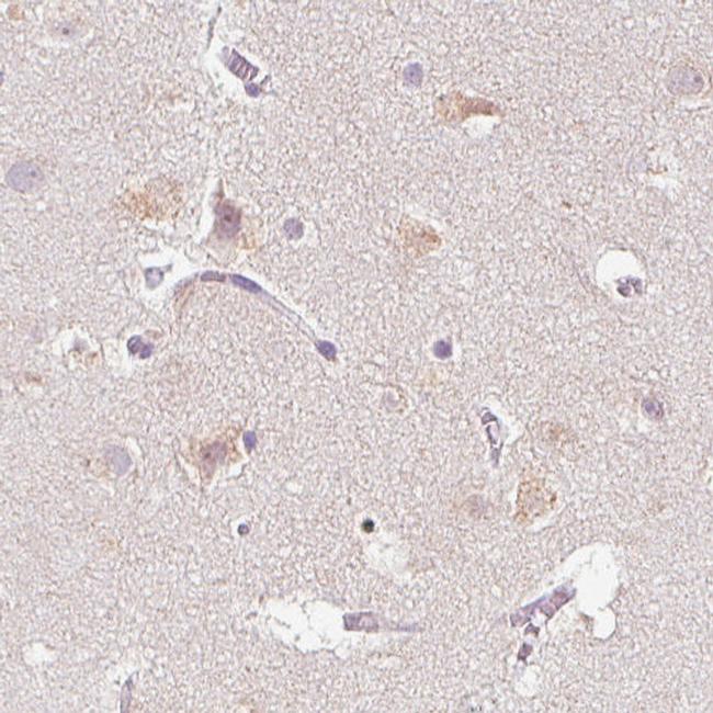 PCM1 Antibody (Monoclonal, CL0206)