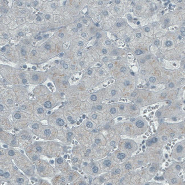 ALP Antibody (MA5-24629)