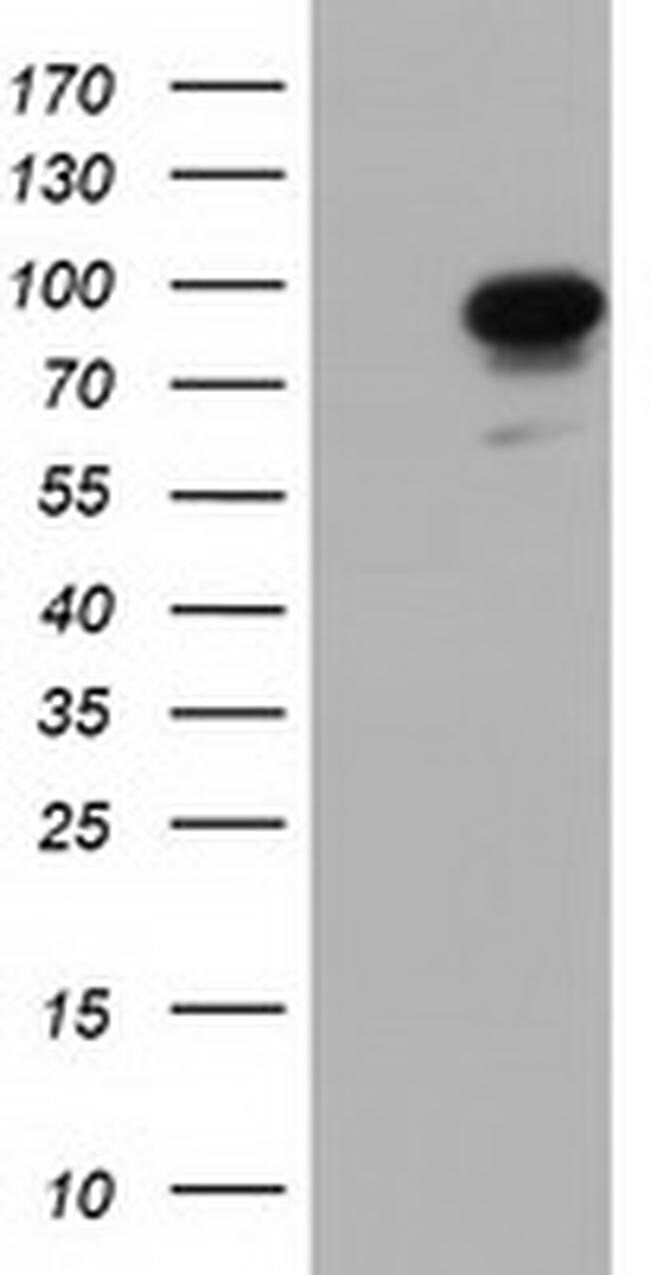 PIK3AP1 Antibody (MA5-25249)