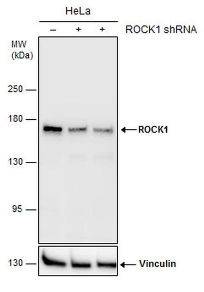 ROCK1 Antibody (MA5-27779)
