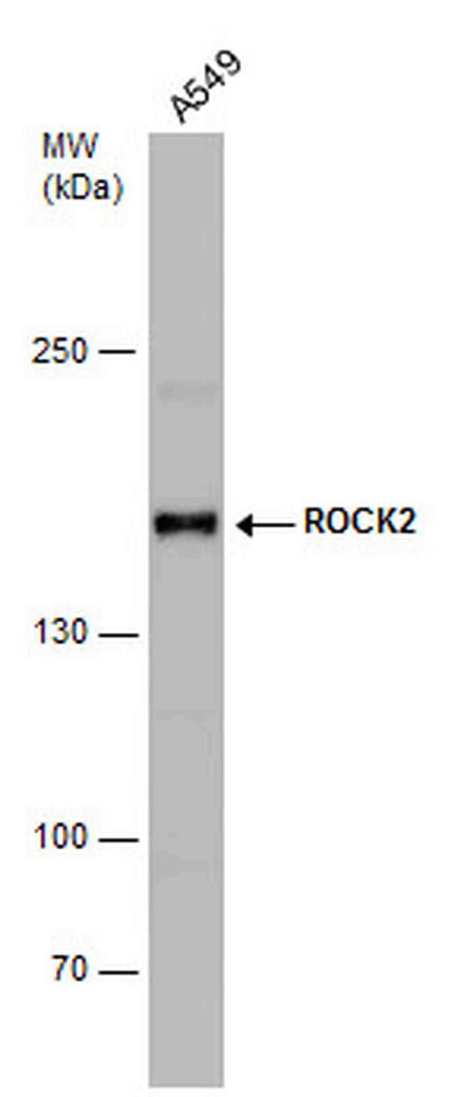 ROCK2 Antibody (MA5-27805)