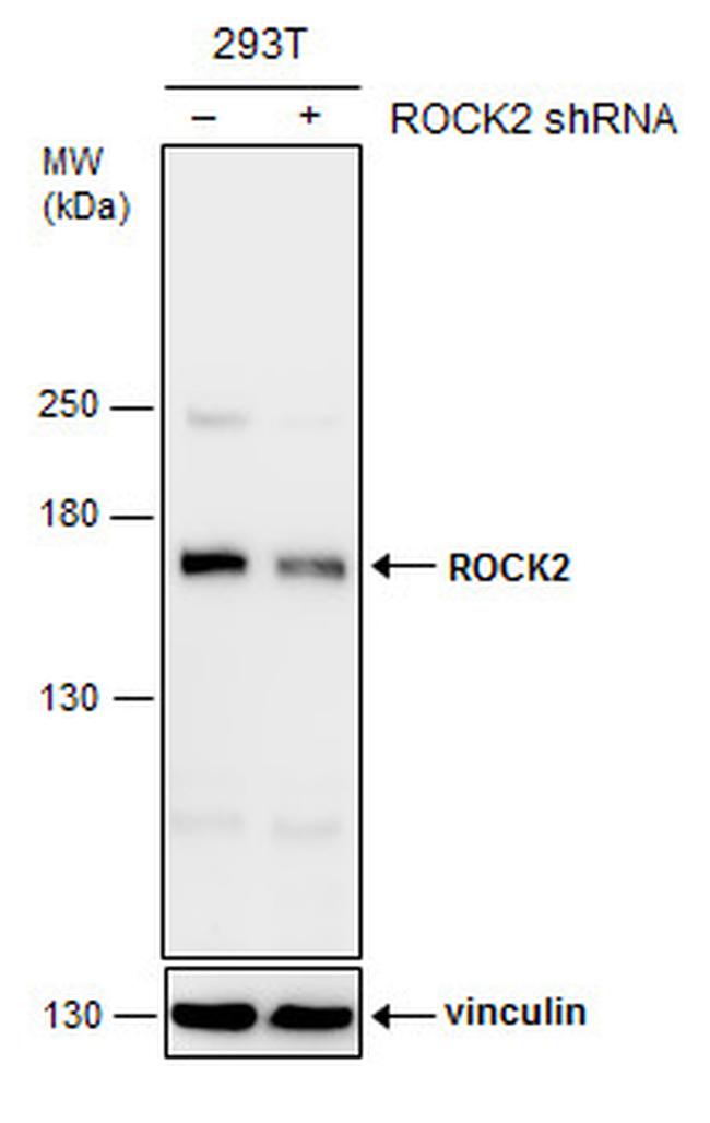 ROCK2 Antibody (MA5-27805)