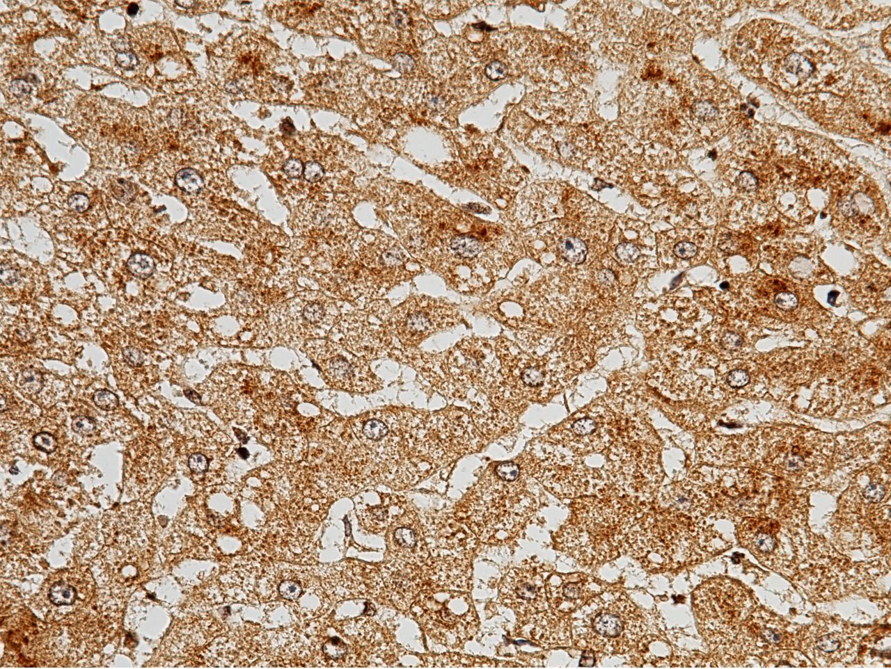 Complement C5 Antibody Ma5 29065