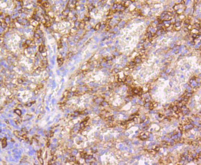 VCAM-1 (CD106) Antibody (MA5-31965)