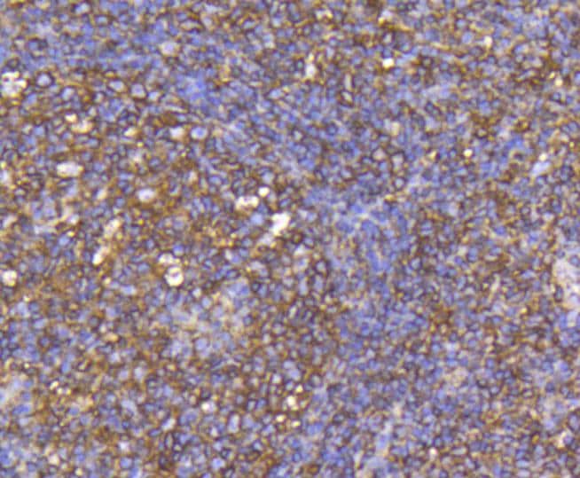 CCR7 Antibody (MA5-31992)
