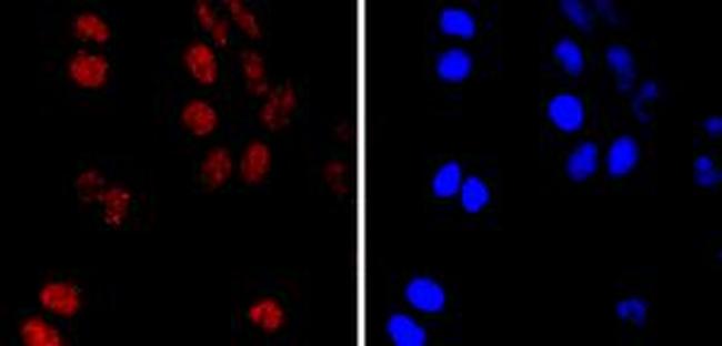 PMS2 Antibody (MA5-32044)