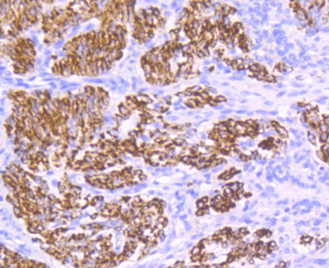 Desmin Antibody (MA5-32068)