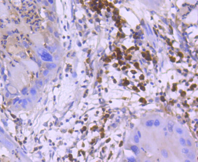 Active/Pro-Caspase 3 Antibody (MA5-32134)