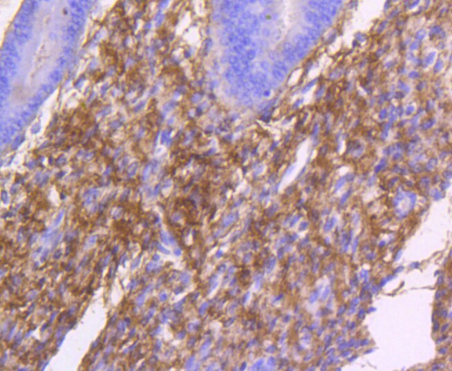 Collagen I Antibody (MA5-32178)