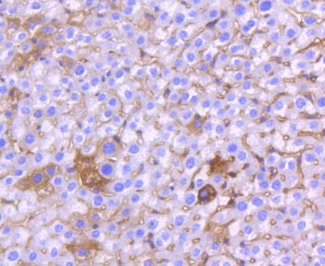 Chk1 Antibody (MA5-32180)