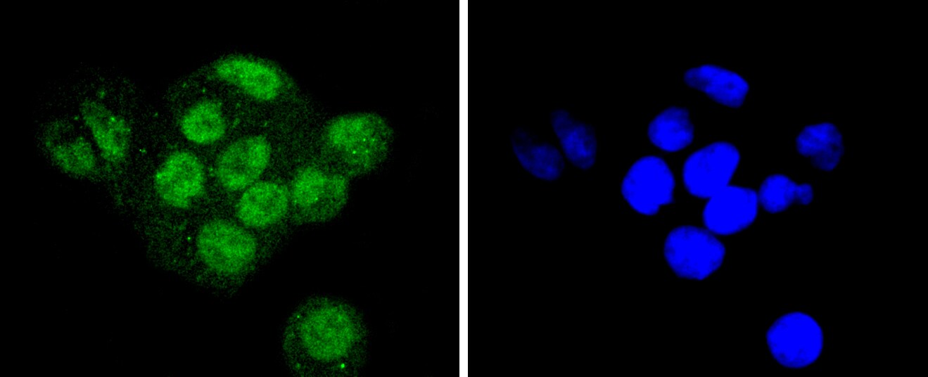 SUMO2/SUMO3 Antibody (MA5-32427)
