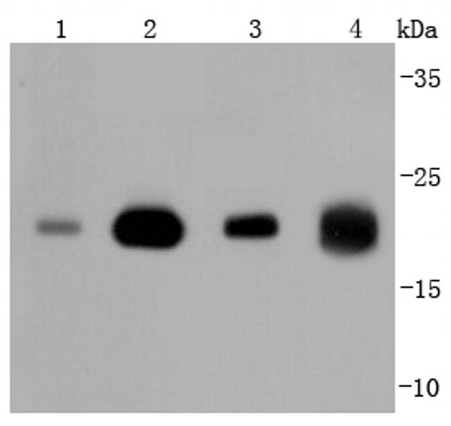 Pan Ras Antibody (MA5-32561)
