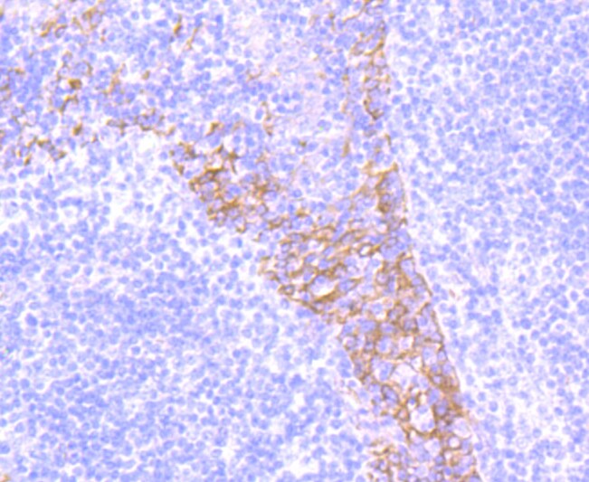 CD104 (Integrin beta 4) Antibody (MA5-32608)