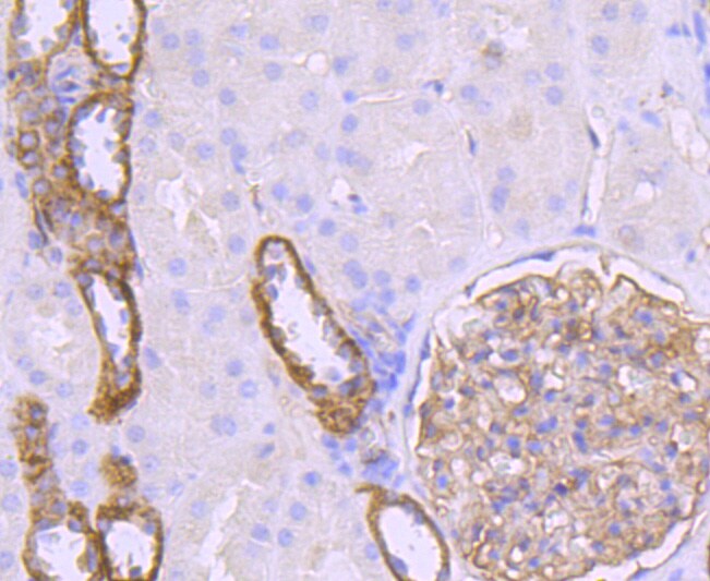 Claudin 5 Antibody (MA5-32614)