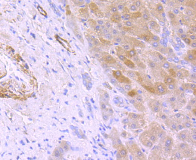 HAMP Antibody (MA5-32669)