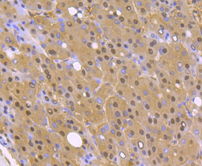 PSMA1 Antibody (MA5-32806)