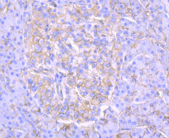 alpha-II Spectrin Antibody (MA5-32826)