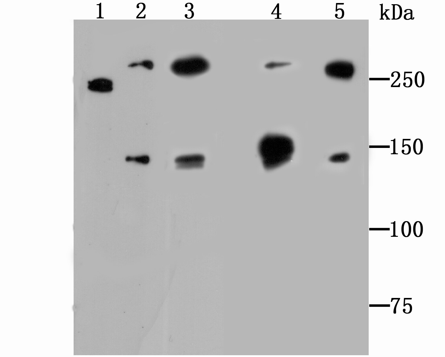 alpha-II Spectrin Antibody (MA5-32826)