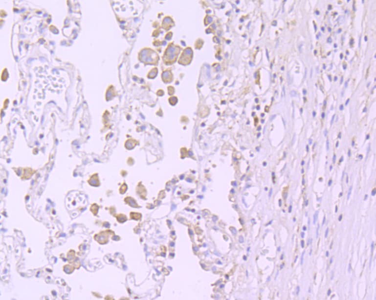 TIM-3 Antibody (MA5-32839)