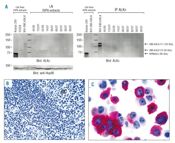 ALK Antibody (Monoclonal, 5A4)