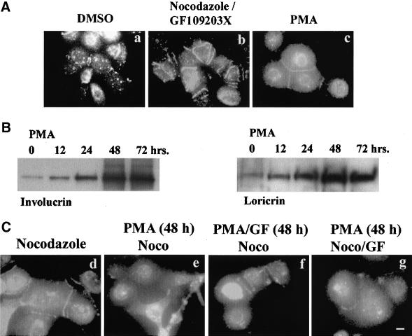 Involucrin Antibody (Monoclonal, SY5)