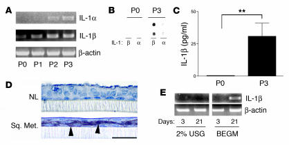 Involucrin Antibody (Monoclonal, SY5)