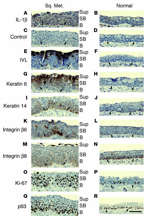 Involucrin Antibody (Monoclonal, SY5)