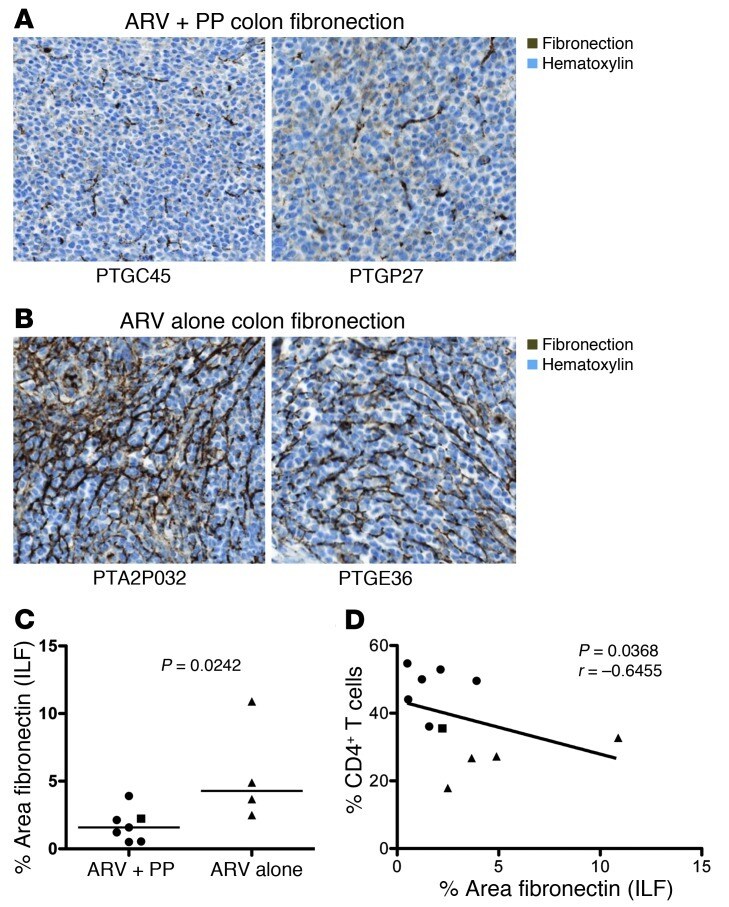 Fibronectin Antibody (Monoclonal, FBN11)