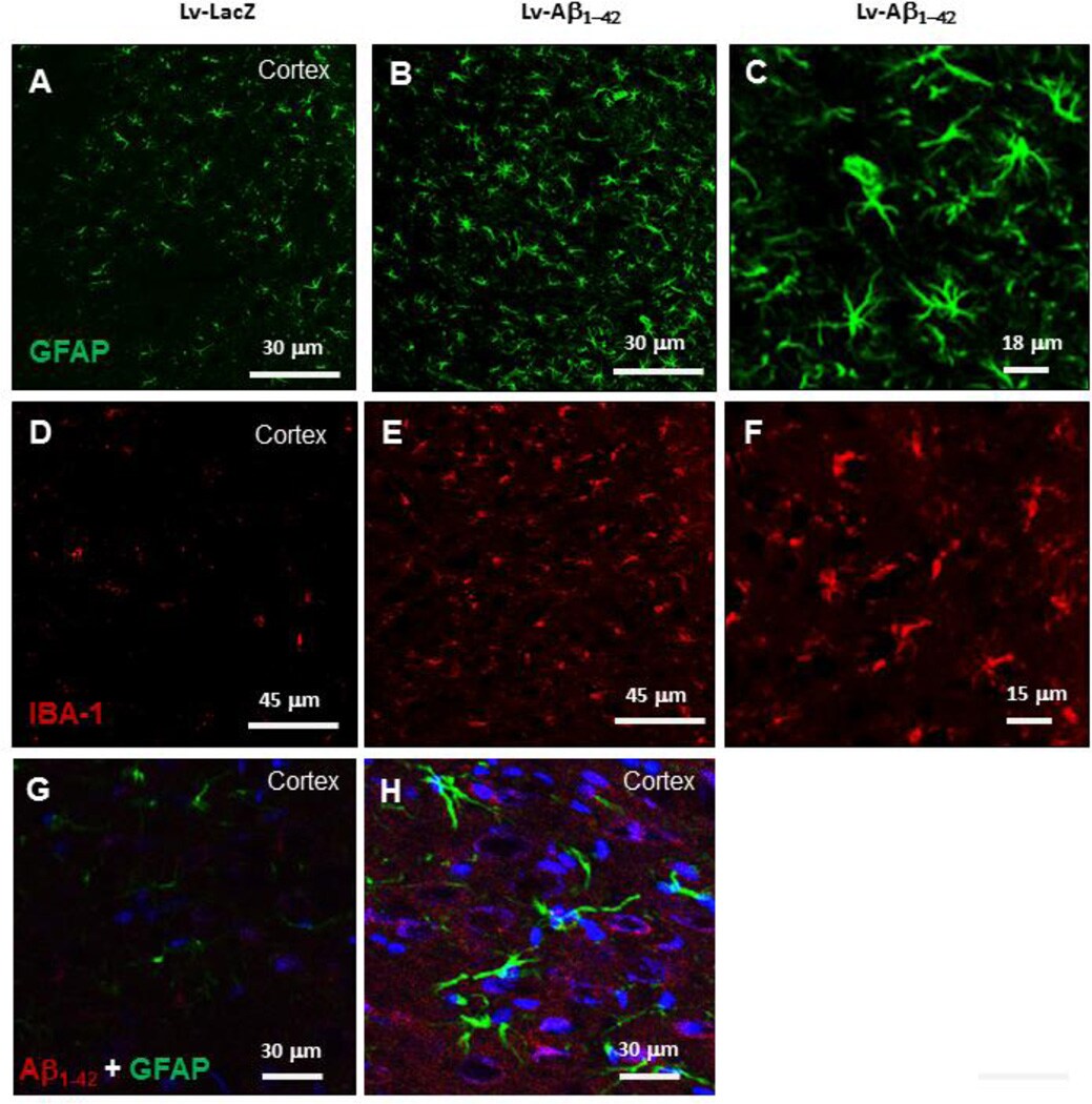 GFAP Antibody (Monoclonal, ASTRO6)
