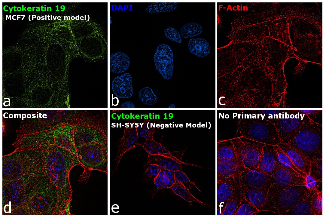Cytokeratin 19 Antibody (MA5-12319)