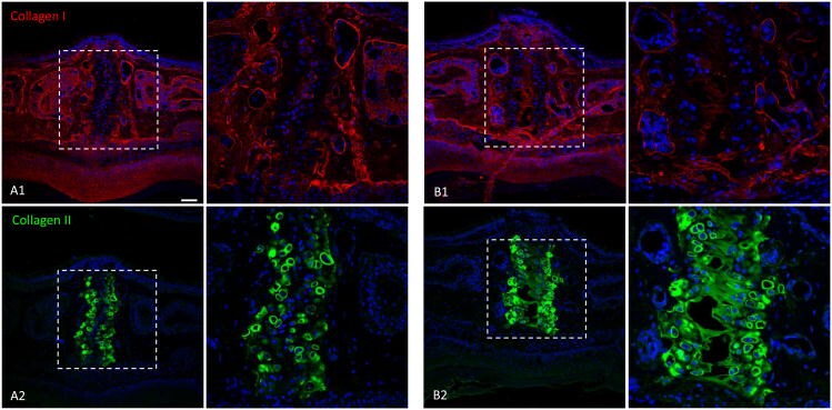 Collagen II Antibody (Monoclonal, 2B1.5)