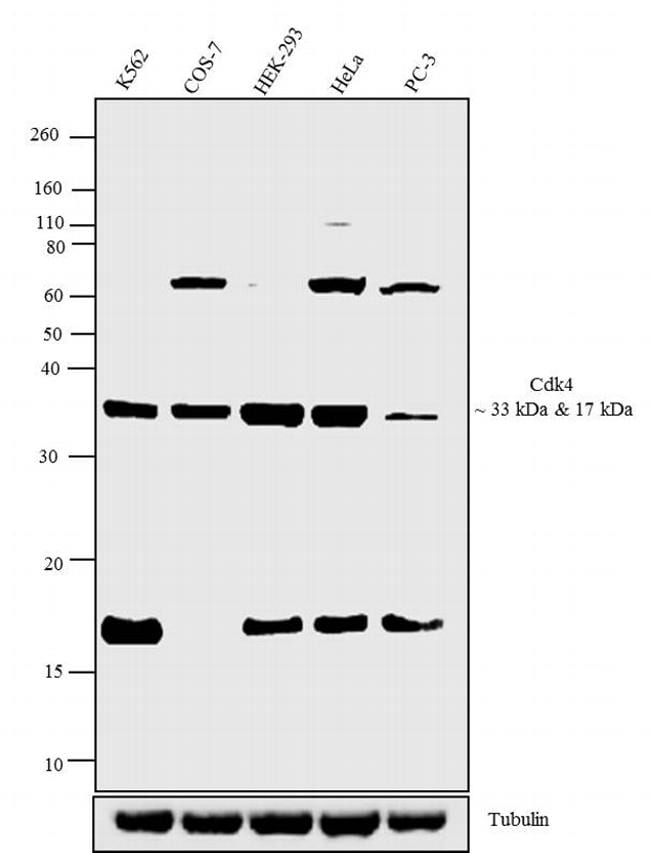Anti-CDK4 Antibodies | Invitrogen