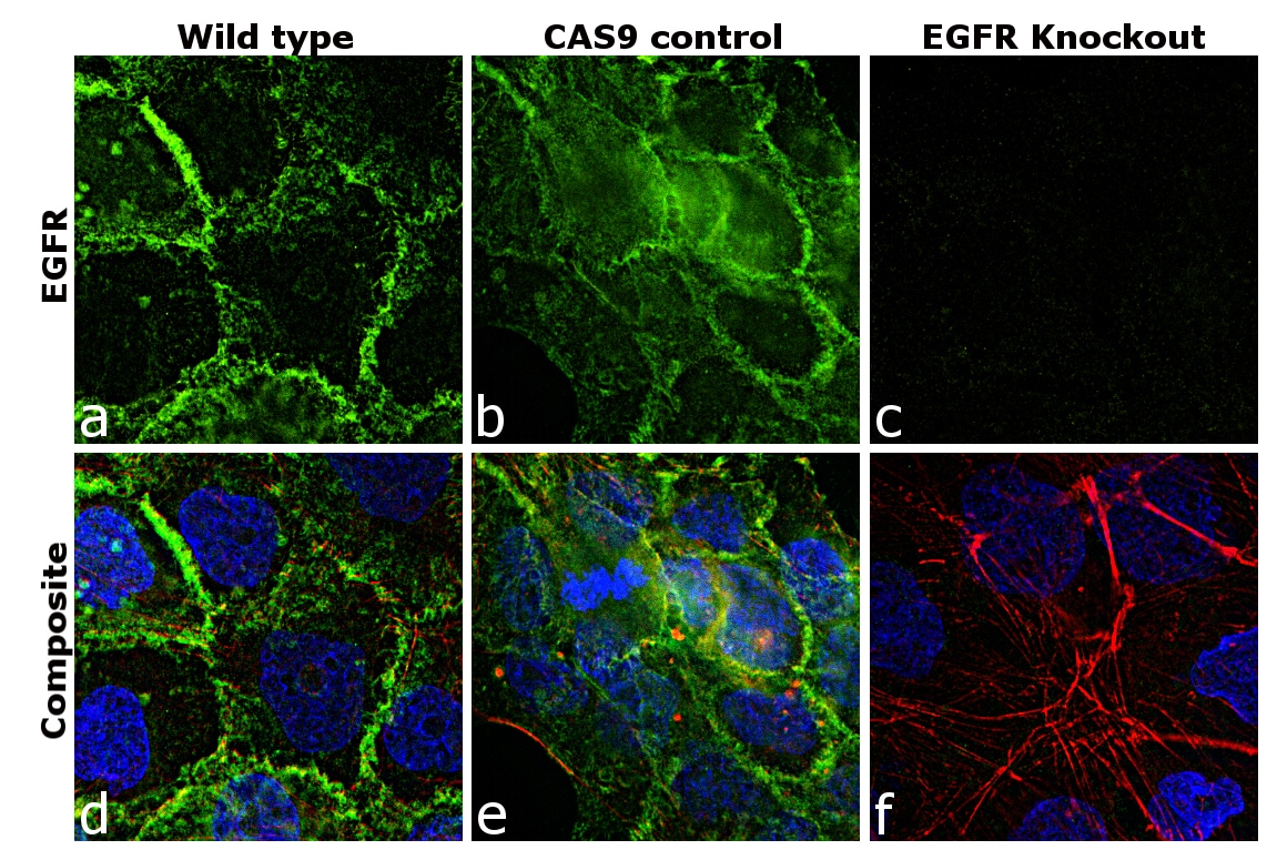 EGFR Antibody (MA5-13269)