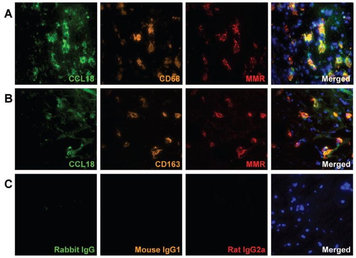 CD68 Antibody (Monoclonal, KP1)