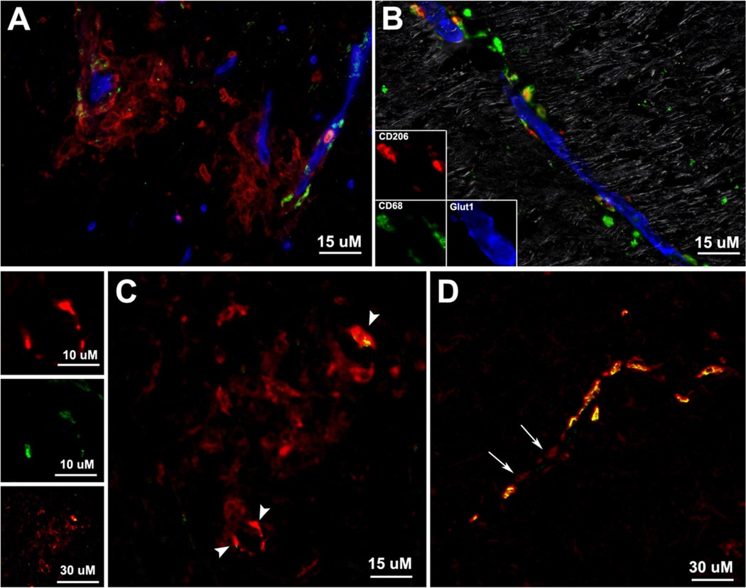 CD68 Antibody (Monoclonal, KP1)