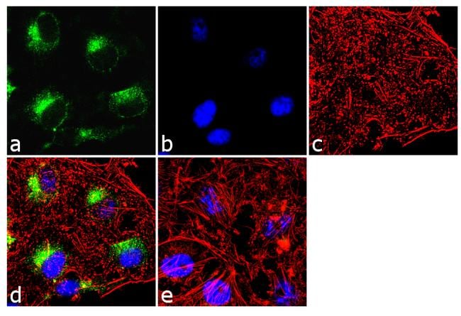Anti-CDK4 Antibodies | Invitrogen