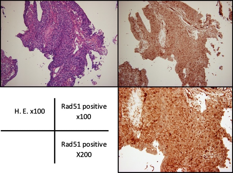 RAD51 Antibody (Monoclonal, 51RAD01 (3C10))