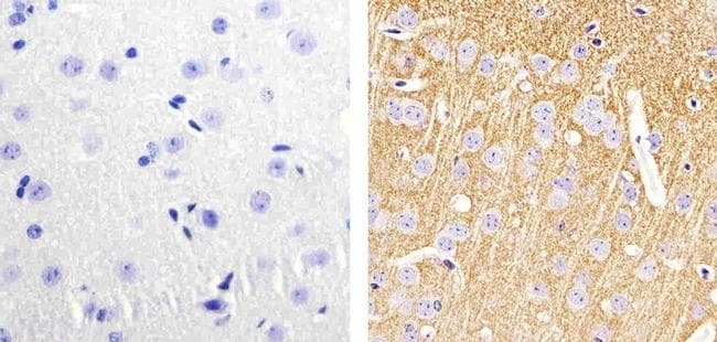 Synaptophysin Antibody (MA5-14532)