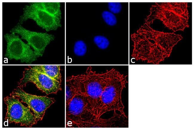 p53 Antibody (MA5-15244)