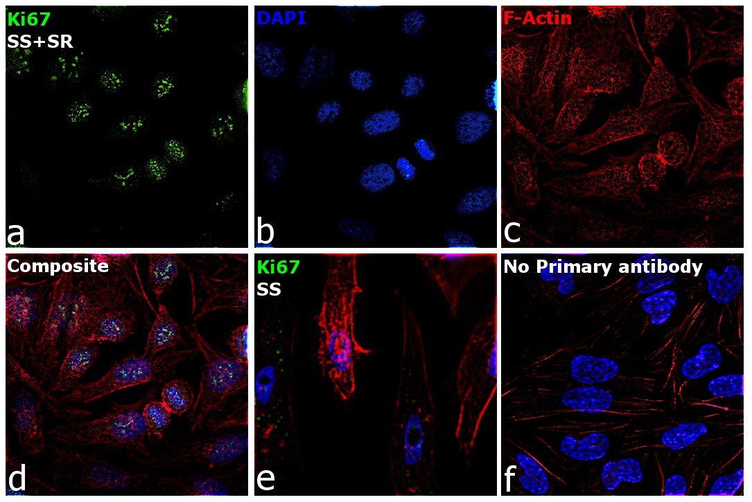 Ki-67 Antibody (MA5-15484)