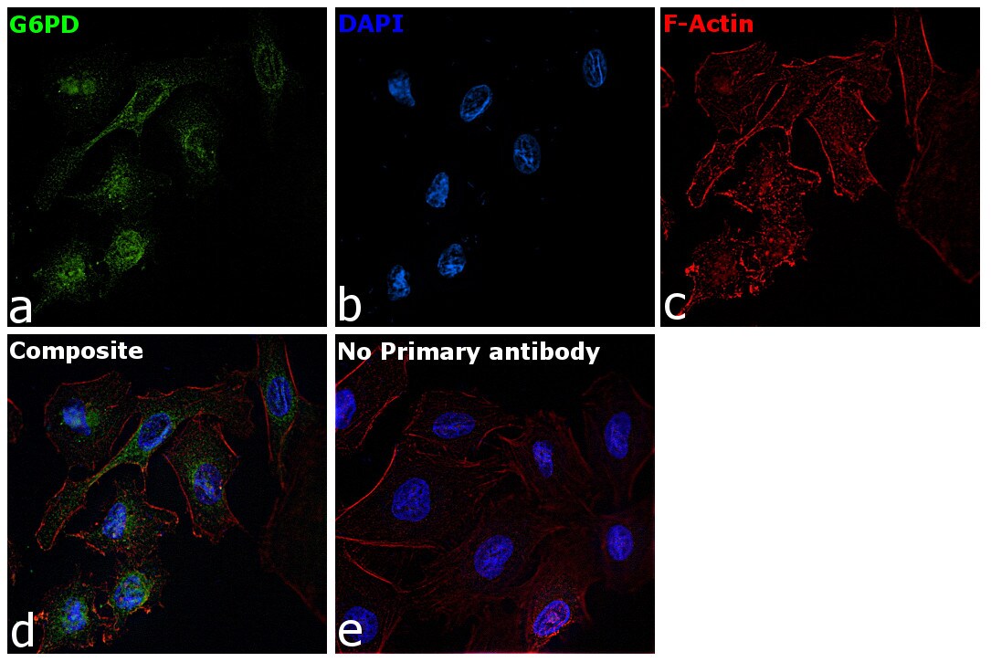 G6PD Antibody (MA5-15918)