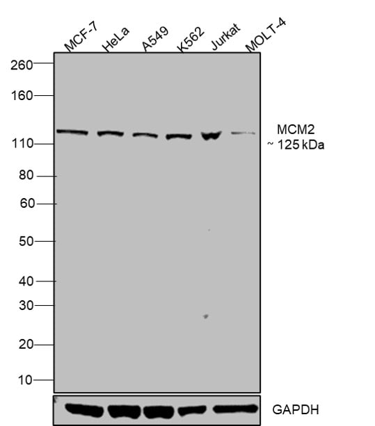 MCM2 Antibody (MA5-15923)